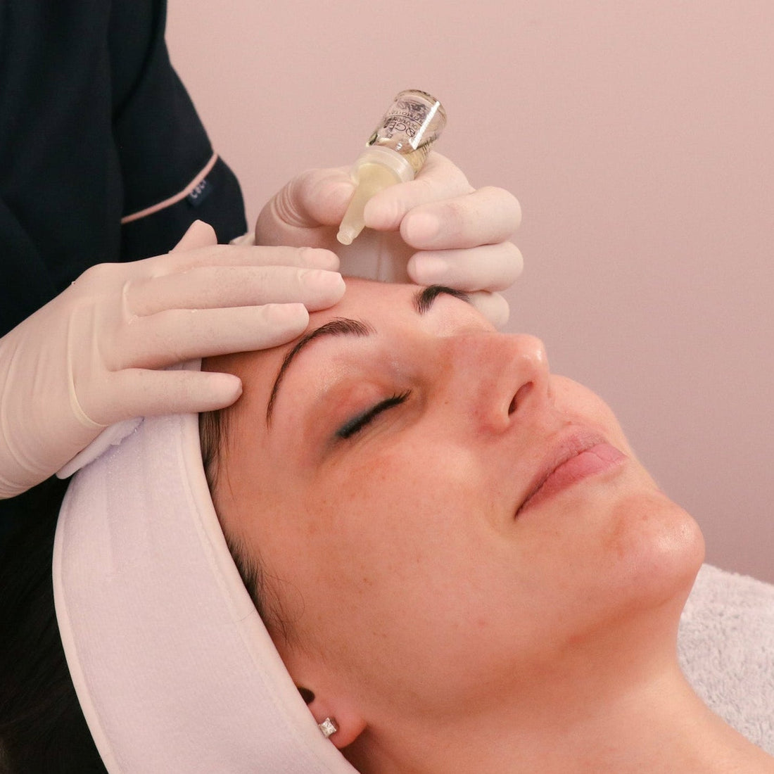 Caci's Signature Peel