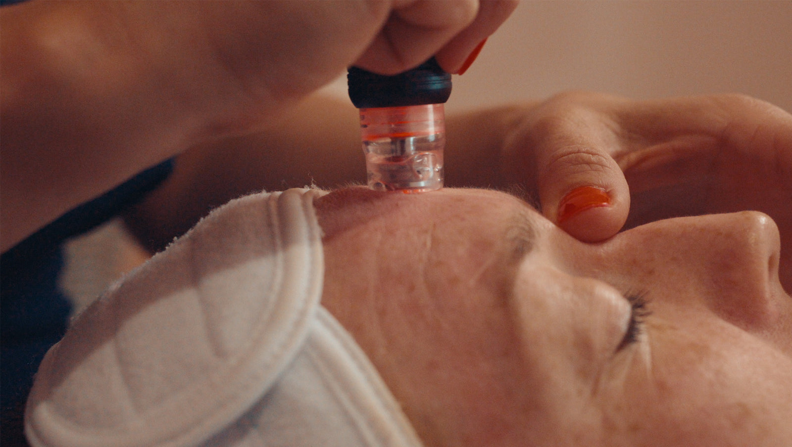 Skin 101: How to Use a Derma Roller